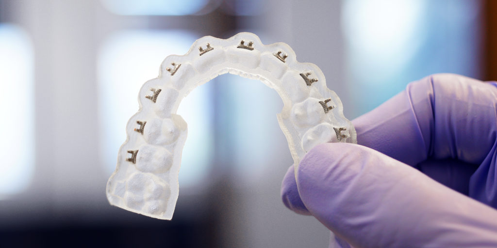 3D Printed Orthodontics: OrthoSelect Interview - SprintRay Inc.