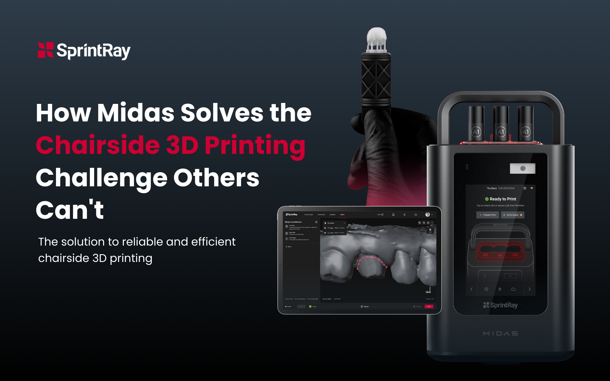 How Midas Solves the Chairside 3D Printing Challenge